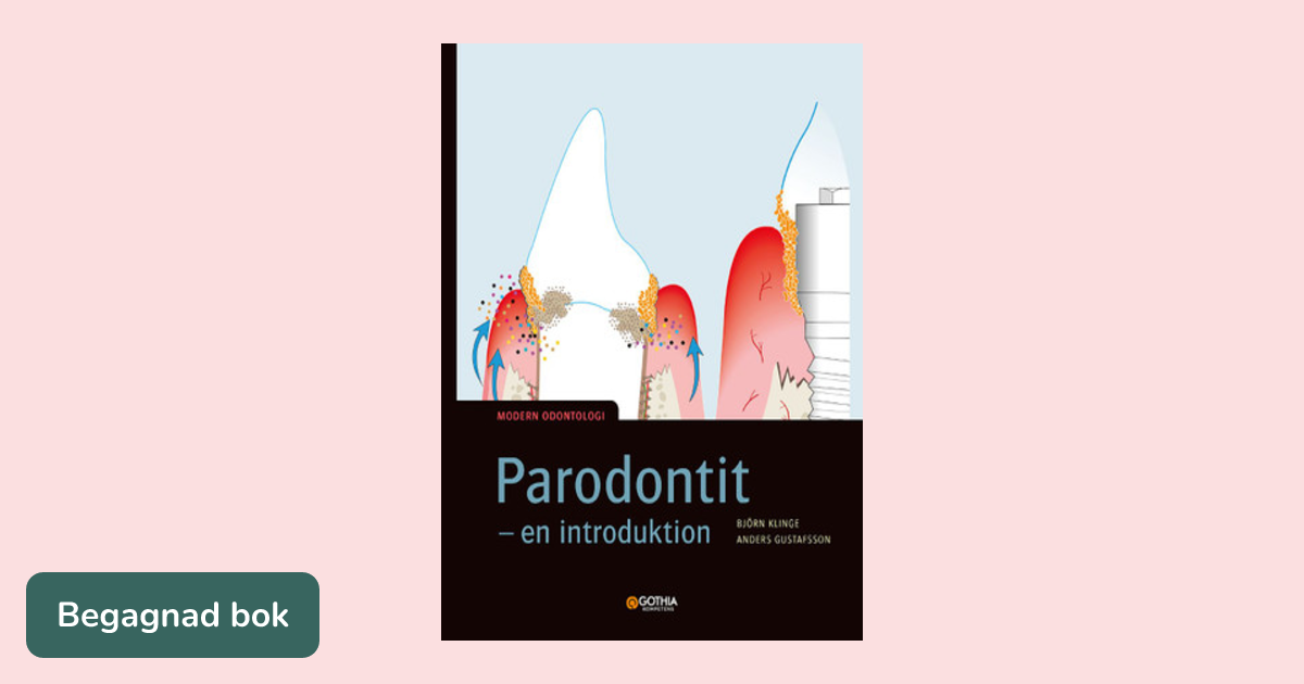 Parodontit : en introduktion - Upplaga 7 | Studentapan
