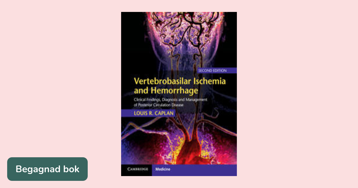 Vertebrobasilar Ischemia and Hemorrhage: Clinical Findings, Diagnosis and Management of ...